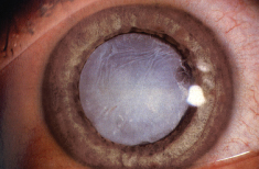 Department of Ophthalmology | 眼科部